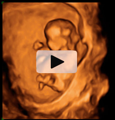Ecografía 2D de la semana 12: Cuánto mide el feto