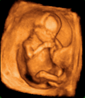 Ecografía 3D de la 15 semanas: Así es el feto